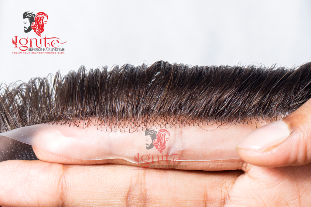 Full Poly Skin Systems - Ignite Hair Systems UK